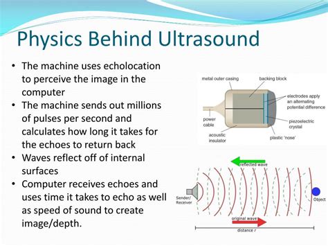 Ppt Ultrasound Powerpoint Presentation Free Download Id 1451781
