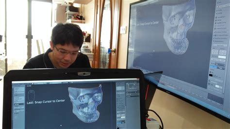 ขอบคุณหมอโบ้ดนะครับที่ไว้ใจ Blender Basic Beginner