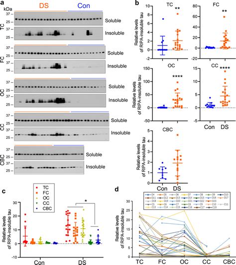 Tau Seeding Activity In Different Regions Of Ds Brain Assessed By The Download Scientific