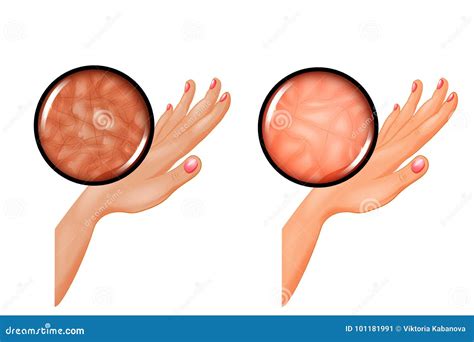 Healthy Skin Diagram With Woman Face Structure Of Stratum Corneum And