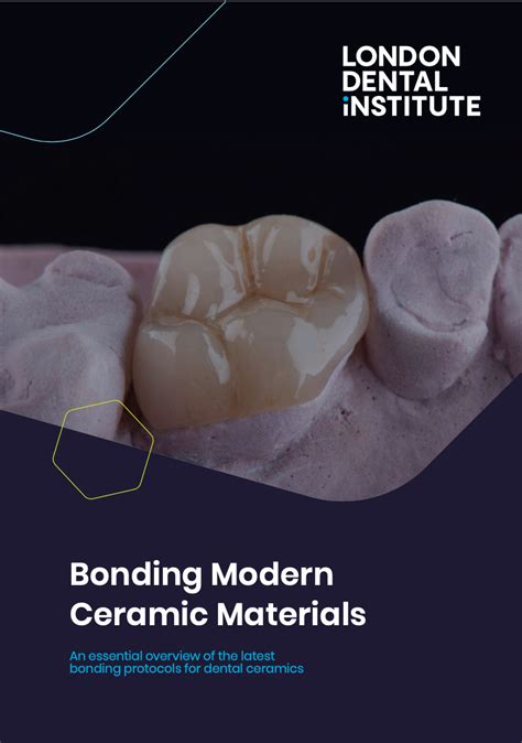 Bonding Modern Ceramic Materials London Dental Institute