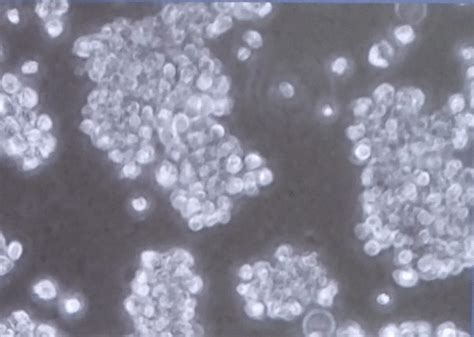 How To Culture Raji B Cells Researchgate
