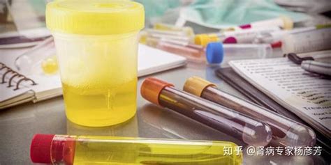从 晨尿”就能看出身体好不好？ 知乎