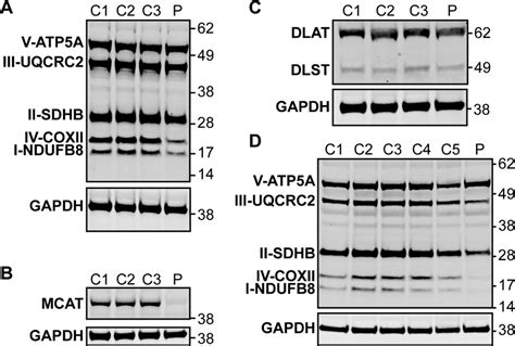 Recessive Pathogenic Variants In Mcat Cause Combined Oxidative