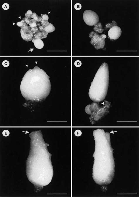 A F Developmental Stages Of Somatic Embryos Obtained By Indirect