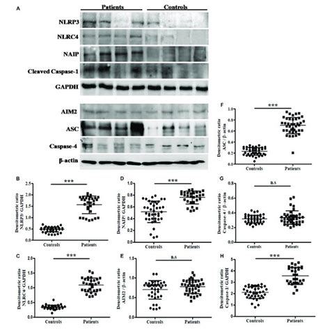 Analysis Of Nlrp3 Nlrc4 Naip Aim2 Asc Caspase 4 Caspase 1