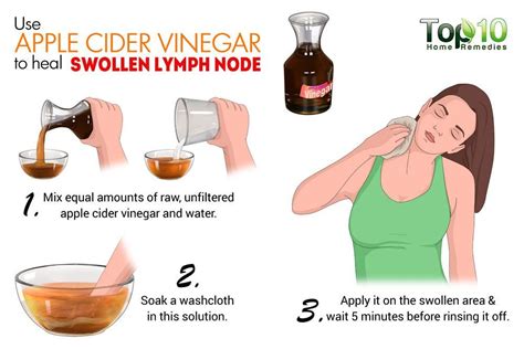 Treatment Of Swollen Lymph Nodes Under Jaw