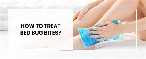 Bed Bug Bites All You Need To Know Bed Bug 911 Bed Bug Bites All You Need To Know Bed Bug 911