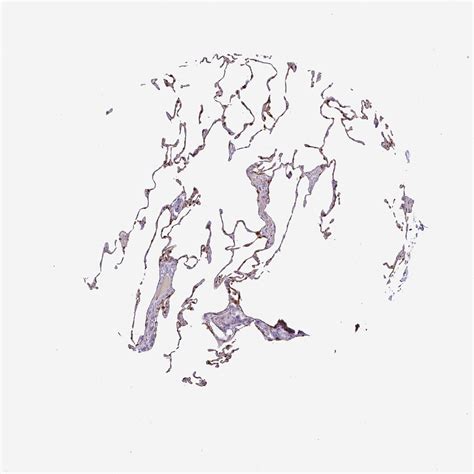 Tissue Expression Of Hopx Staining In Lung The Human Protein Atlas