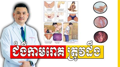 ជំងឺ កាមរោគ អ្វីដែលអ្នកត្រូវដឹង Sexual Transmission Disease Youtube