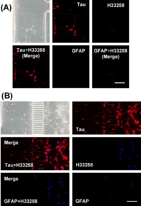 Figure S16 Specificity Of The Immunocytochemistry Assay Hippocampal