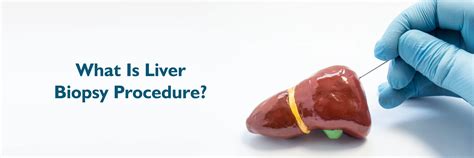 Liver Biopsy Procedure