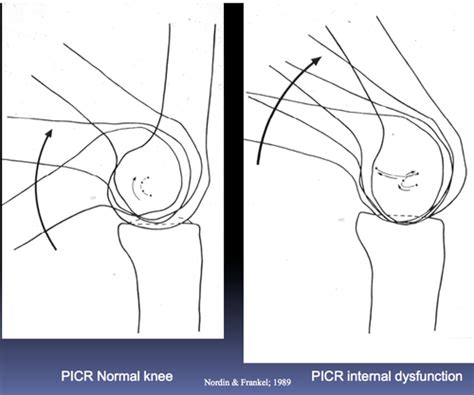 Biomechanics Linear Kinematics And Angular Kinematics Flashcards Quizlet
