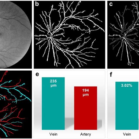 Automated Arteries And Veins Classification Of The Wide Field Fundus