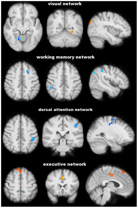 Functional Connectivity Analysis At The Level Of Resting State