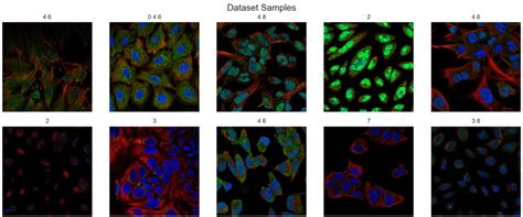Medical Multi Label Classification With Pytorch And Lightning