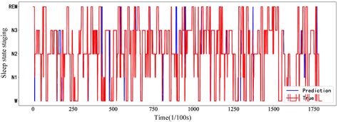Deep Learning Model Of Sleep Eeg Signal By Using Bidirectional