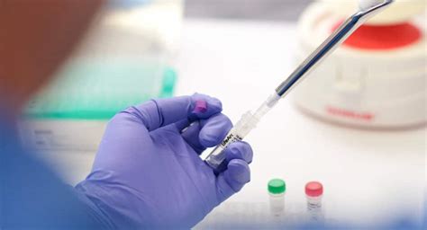 Tuberculosis Molecular Bacterial Load Assay Tb Mbla Lifearc