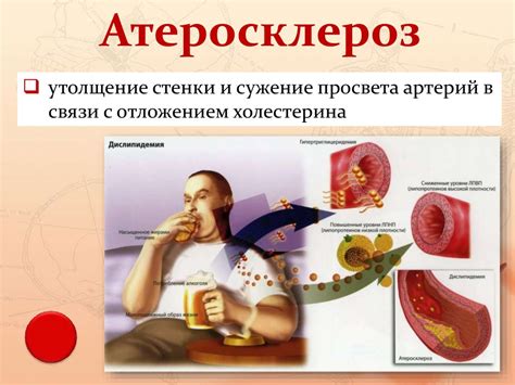 Профилактика нарушения деятельности сердечно сосудистой системы