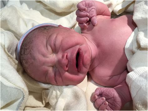 Neonatal Dermatology Primary Care Clinics In Office Practice