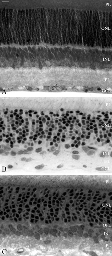 Light Microphotographs Of Retinal Sections A Sham Operated Retina Download Scientific