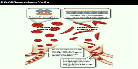 Voxelotor Drug Approvals International