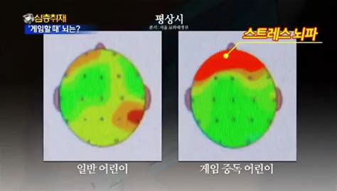 어린이 스마트폰 게임중독 심각 뇌파게임으로 전두엽발달시켜 집중력 키워야 네이버 블로그