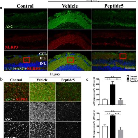 A Oct Images Showing Intra Retinal Hrf Red Arrows And Sub Retinal Download Scientific Diagram