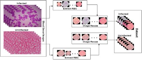 Generating Process Of Malaria Dataset From Blood Smear Images