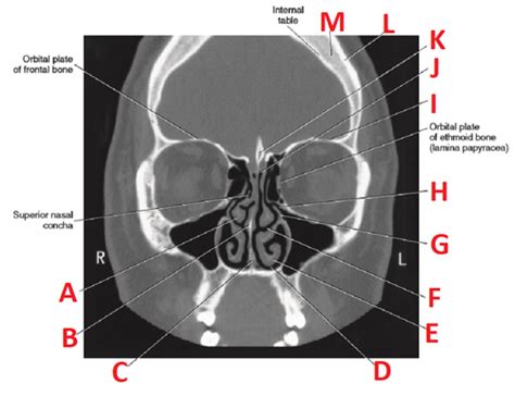Sectional Anatomy Chapter 2 Cranium And Facial Bones Flashcards Quizlet