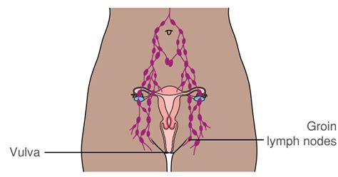 Lymph Nodes In The Groin Diagram