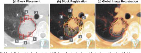 Figure 1 From A Block Matching Based Registration Algorithm For