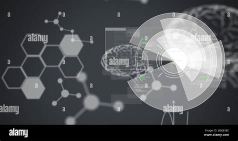 Image Of Scope Scanning Medical Data Processing And Human Brain Stock