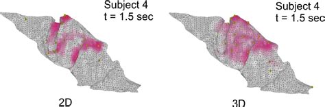 Figure 1 From Spatiotemporal Response Patterns In Sensory Motor Cortex Using Surface Based