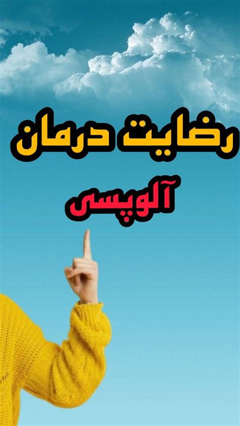 ‎رویش مو ریش آلوپسی ارثی‎ ‎ریزش موهات کلافت کرده 🔴profesormoo
