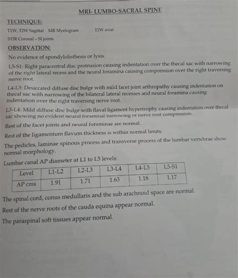 Can Someone Explain Rsciatica