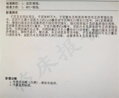 外生型子宫颈癌常表现为接触性出血