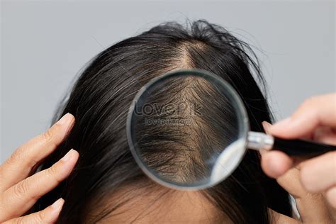 여성 탈모 고민 클로즈업 사진 무료 다운로드 Lovepik 여성 탈모 고민 클로즈업 사진 무료 다운로드 Lovepik