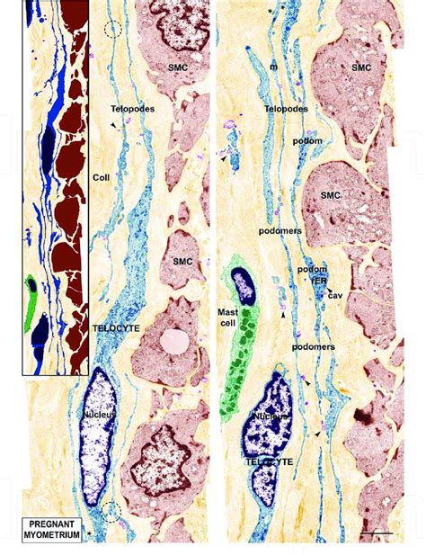 Representative Ultrathin Section Of Human Pregnant Myometrium