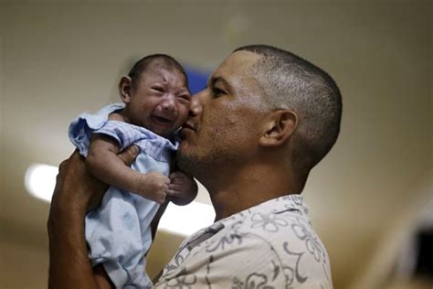 50 Facts About Familial Microcephaly With Normal Intelligence