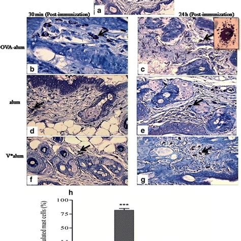 Histological Analysis Of Mast Cell Degranulation In Skin Following