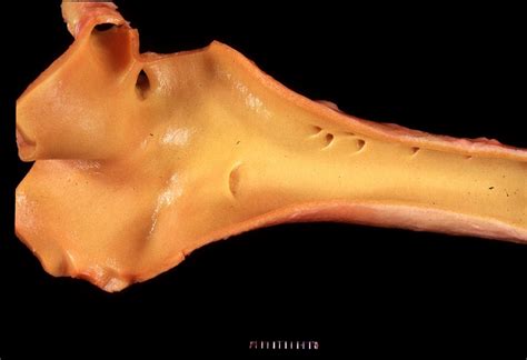 Causes Of Icterus Pathology And Ponies