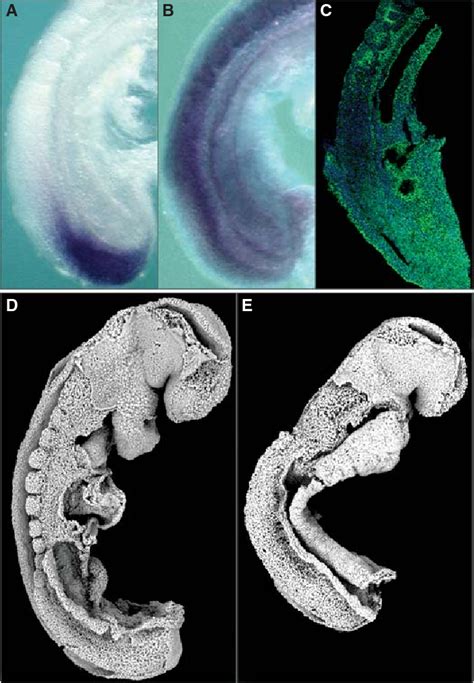 Figure 1 From Signaling Gradients During Paraxial Mesoderm Development