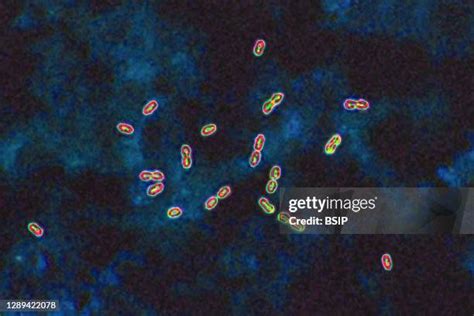 Pneumococcal Disease Photos And Premium High Res Pictures Getty Images