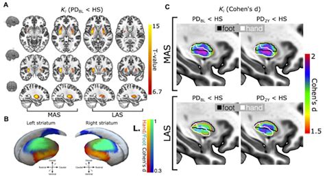Build Tailored Multimodal Neuroimaging Pipelines By Josepineda958 Fiverr