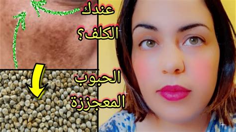 وصفة لإزالة الكلف والبقع الداكنة والعميقة والنمش في أسرع وقتعلاج