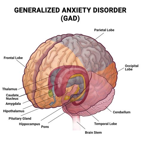 Generalized Anxiety Disorder Panic Disorder Vs Generalized Anxiety
