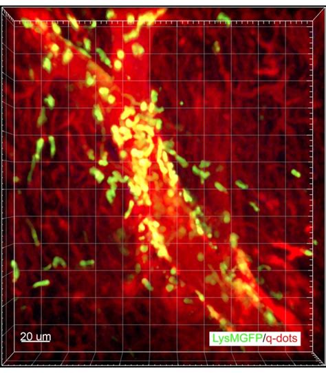 Video Mouse Heterotopic Cervical Cardiac Transplantation Utilizing Vascular Cuffs