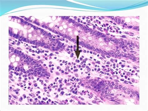 Procedure For Staining On Routine Histopath Ppt