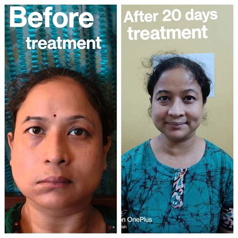 snehasish mandal on linkedin ortho and neuro physiotherapy clinic